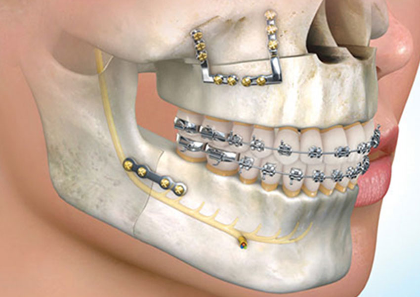 Oral And Maxillofacial Surgery Dr Joan s Specialists Dental Clinic Oral And Maxillofacial Surgery Dr Joan s Specialists Dental Clinic